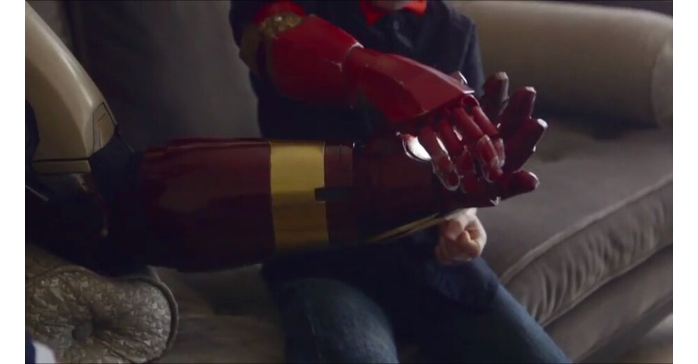 Microsoft & Limbitless Solutions - Junge erhält Armprothese von »Iron ...